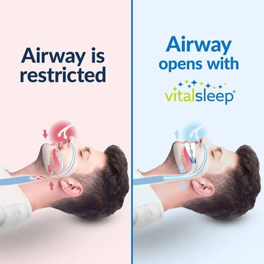 Products For Snoring | Best Snoring Products - VitalSleep